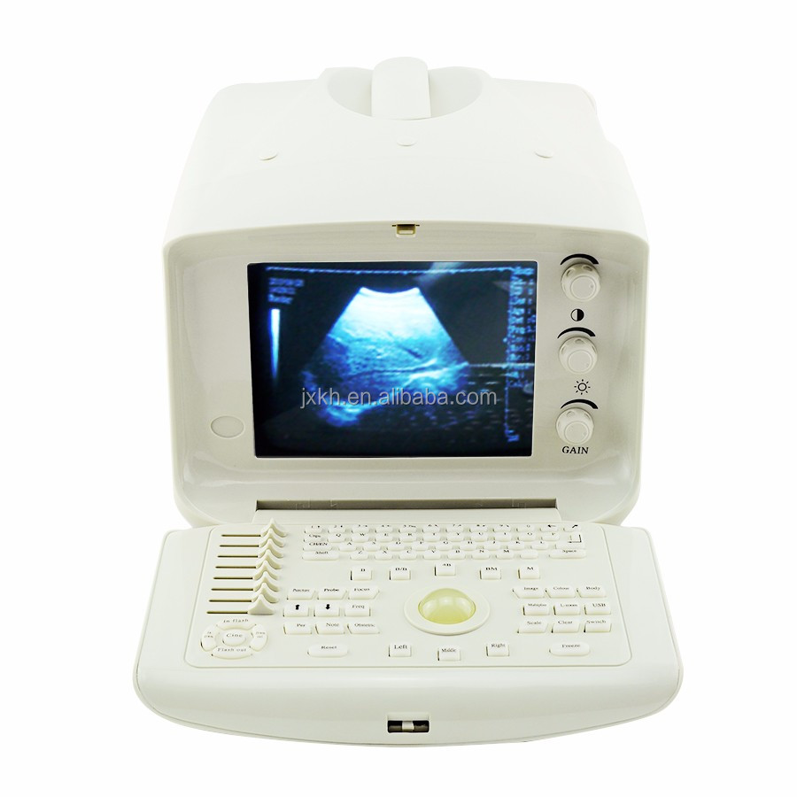 Medical Devices Convex,Transvaginal,Linear,Rectal Probe Cheap Ultrasound Scanner China Portable ...